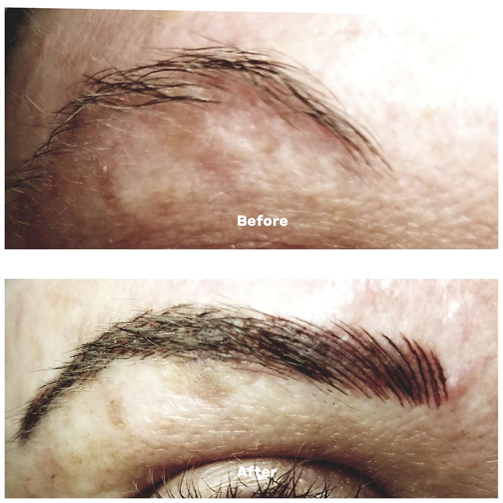 before and after eyebrows - North Dallas Permanent Cosmetics